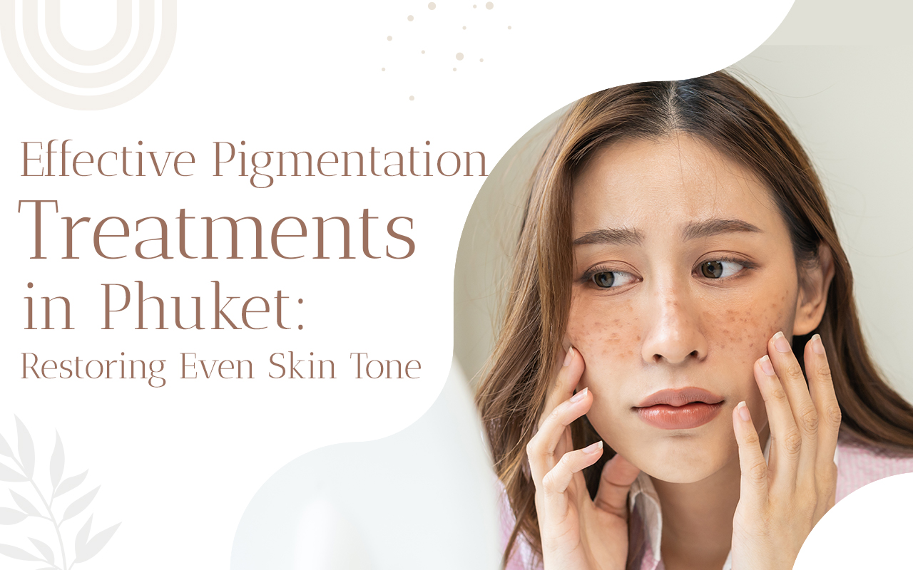 Effective Pigmentation Treatments in Phuket